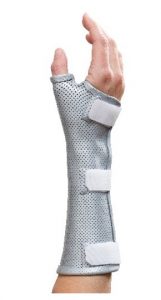 De Quervain’s Tenosynovitis | Specialised Hand Therapy