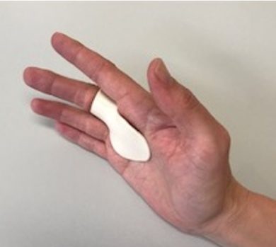 Trigger Finger/Trigger Thumb | Specialised Hand Therapy